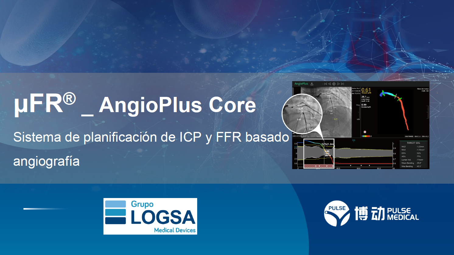 Angio Plus – µFR | LOGSA | Distribuidor de material quirúrgico en España